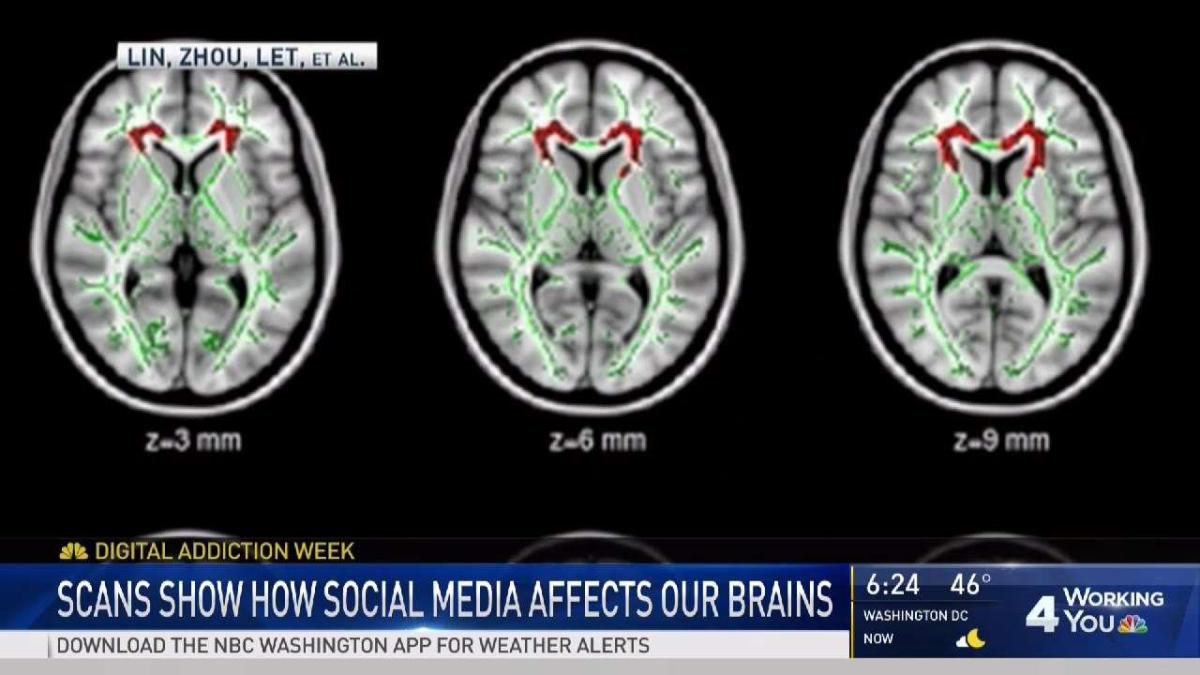 Digital Addiction: Overuse of Technology Can Rewire Your Brain – NBC4 ... Digital Addiction: Overuse of Technology Can Rewire Your Brain – NBC4 ...