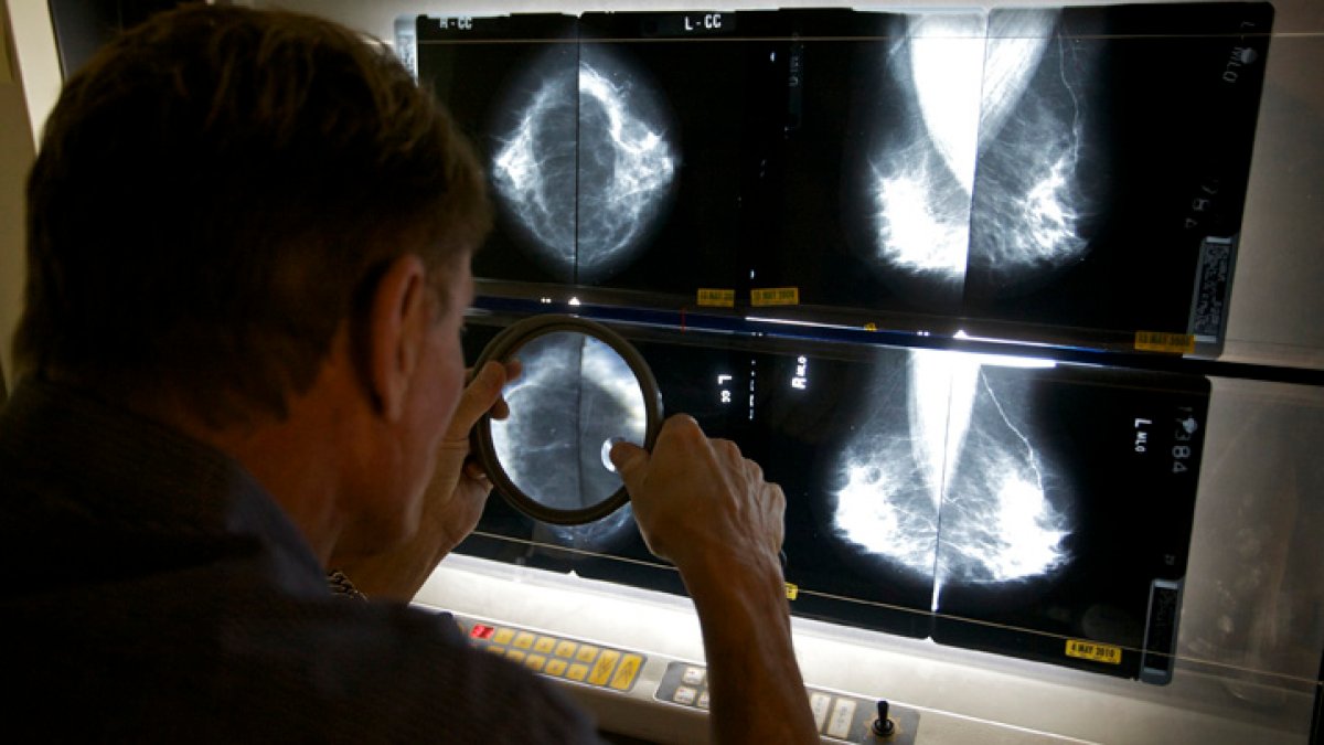 What is the recommended age for a mammogram? Panel issues new ...