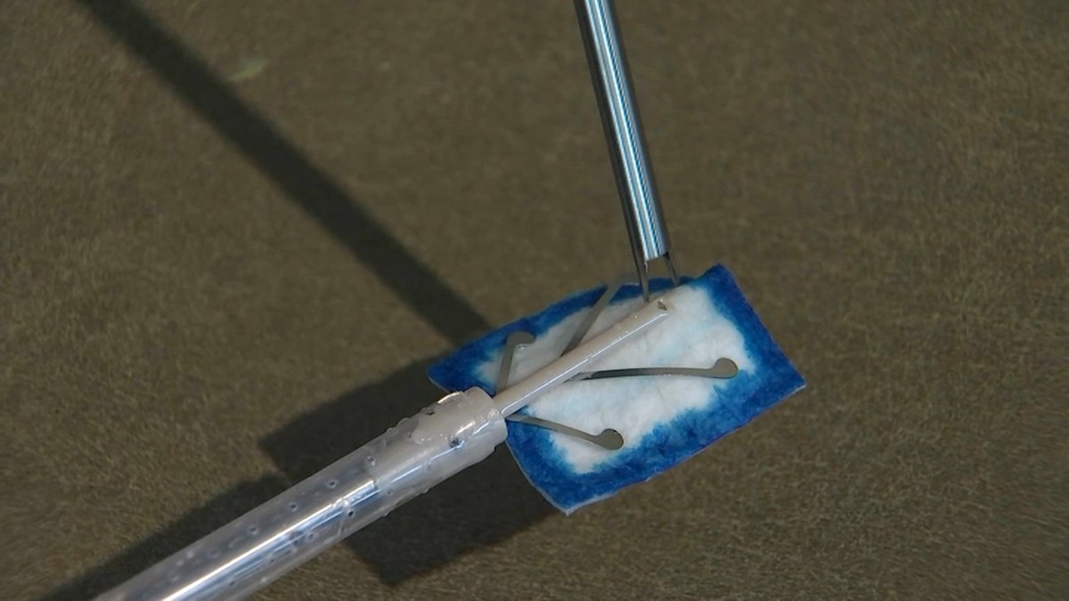 Implant Derived From Cow Helps Patients Recover From Torn Rotator Cuff ...