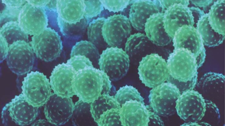 Pollen Count Spikes – NBC4 Washington