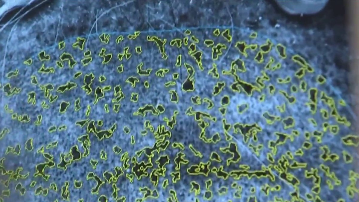 Doctor’s Tips on Rescuing Your Skin After Blue Light Damage from ...