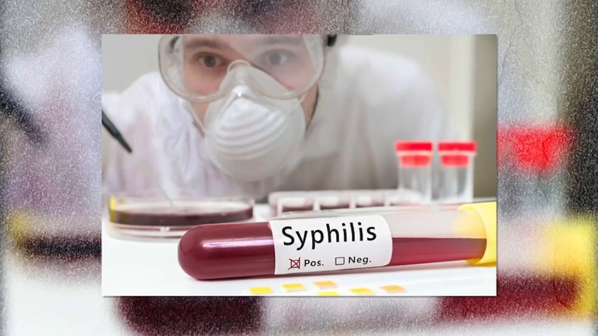 Syphilis Spike in Maryland Overshadowed by COVID-19’s Early Days – NBC4 ...