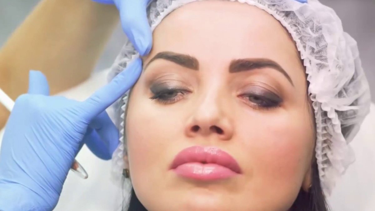 Researchers Say Botox Can Boost Mental Health Nbc4 Washington