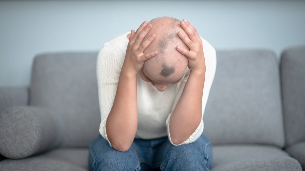 Fda Approves First Drug To Treat Hair Loss Caused By Severe Alopecia Trendradars Latest
