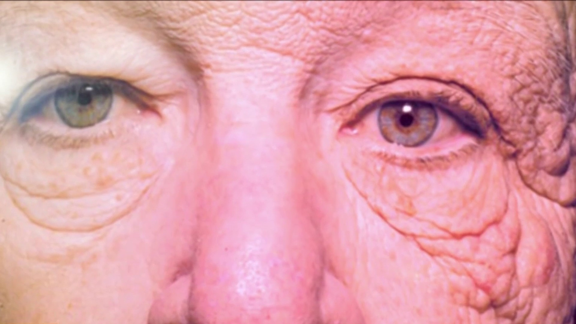 Fact Or Fiction 3 Skin Cancer Myths Debunked Nbc4 Washington 3827