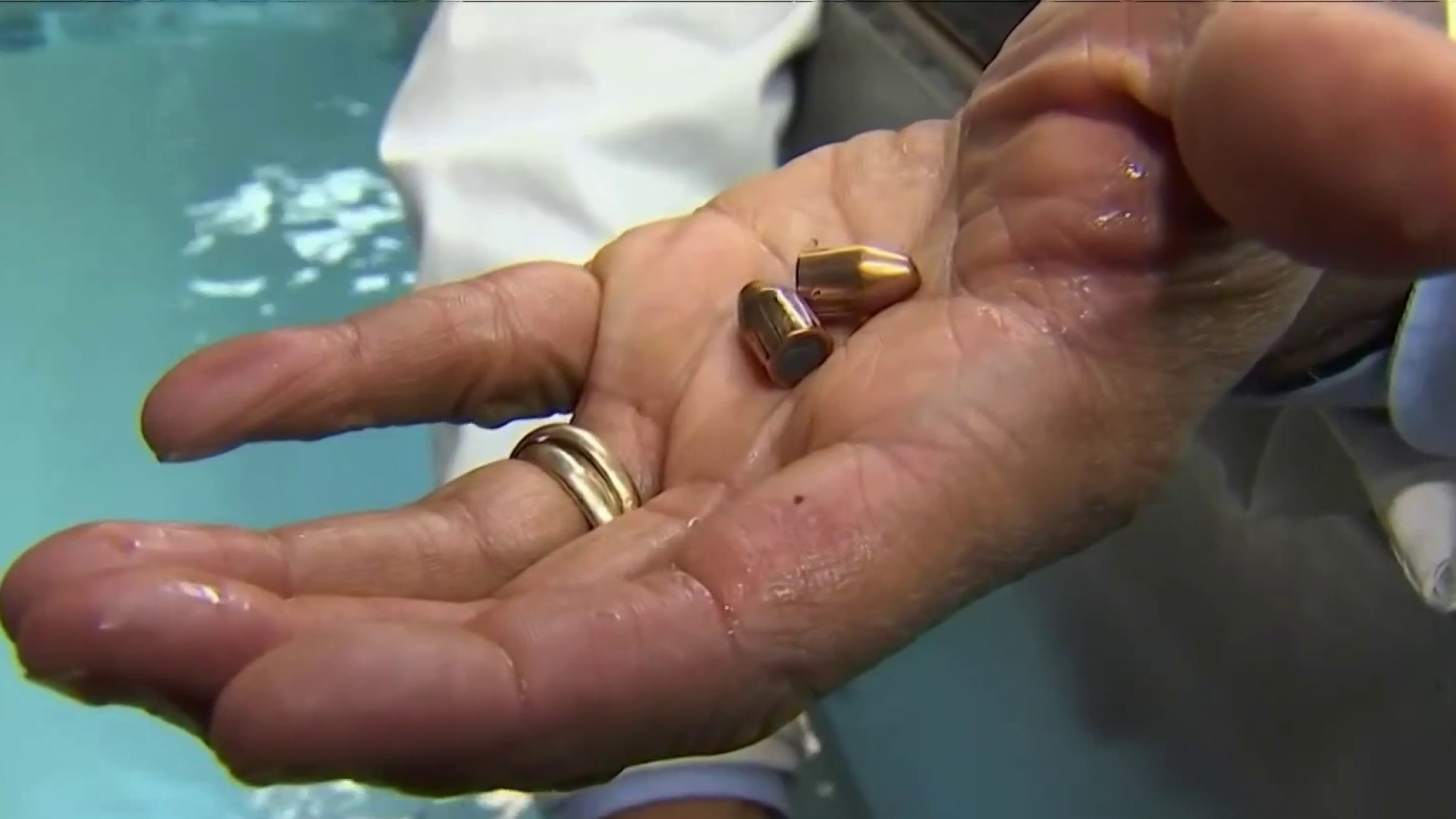 Md. Woman With Rare Form of Amnesia Located – NBC4 Washington