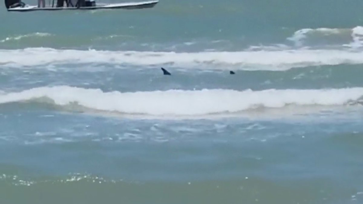 North Texas woman shares story of being attacked by shark – NBC4 Washington