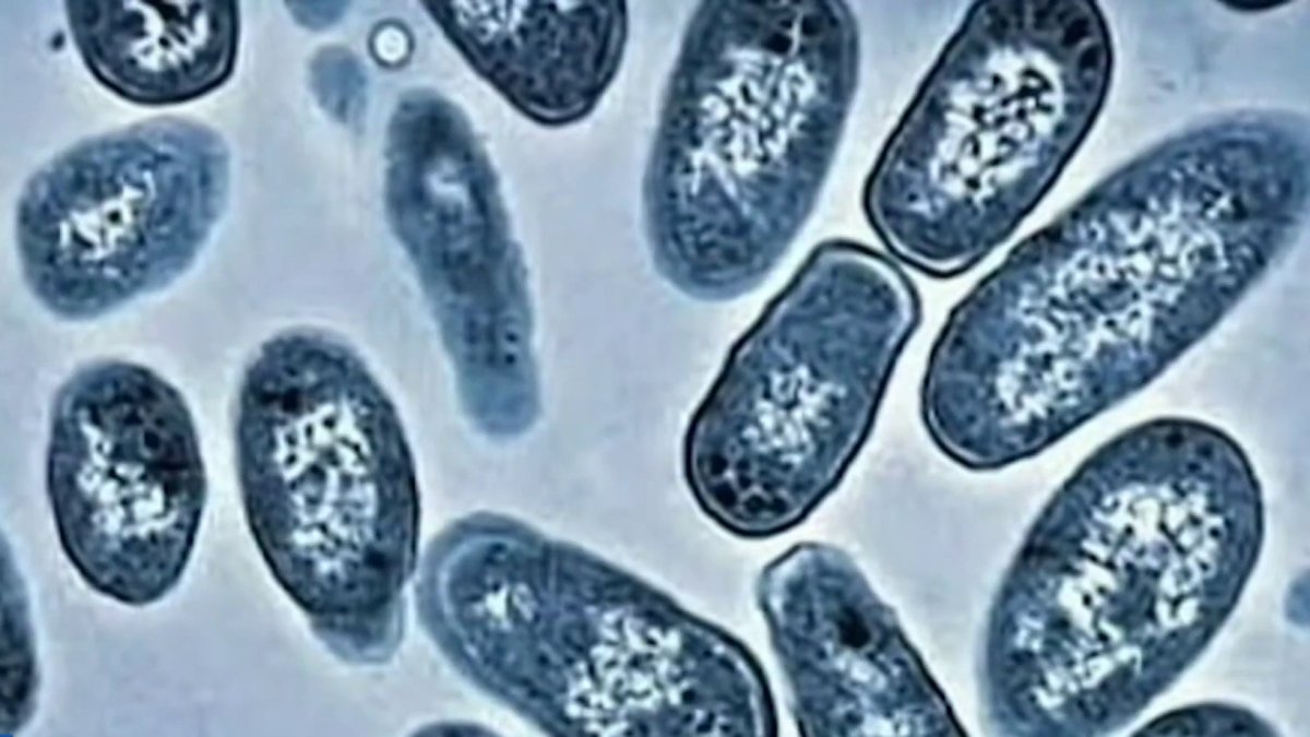 Local food safety expert weighs in on recent E. coli outbreaks – NBC4 ...