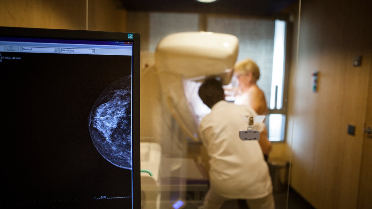 Dense breasts can make it harder to spot cancer on a mammogram – NBC4 ...