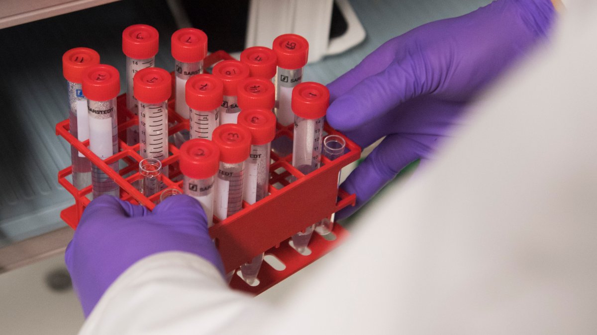 Trump’s NIH layoffs could waste years of cancer research – NBC4 Washington