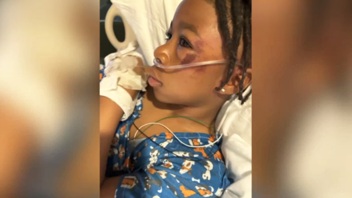 ‘She ran over my son’: 9-year-old seriously hurt in DC hit-and-run ...