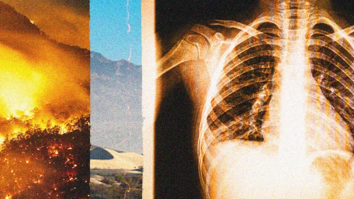 California could face record Valley fever fungal infections – NBC4 ...