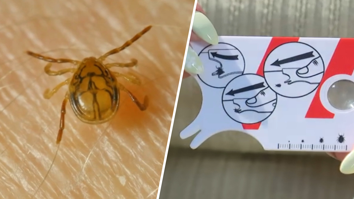 Tick check: Alexandria gives warning, hands out tick remover tool ...