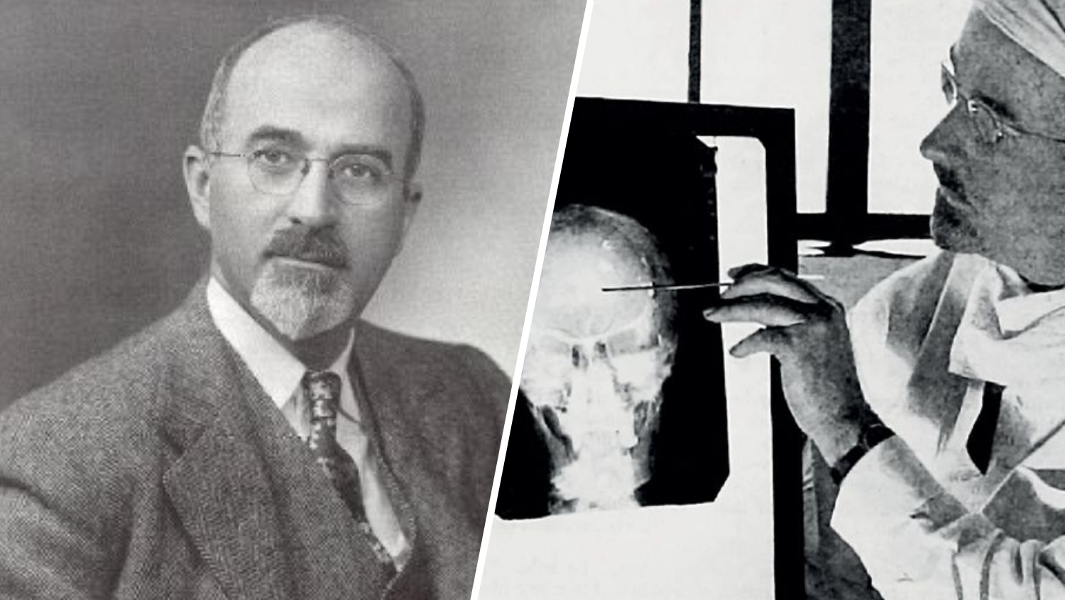 Look in DC’s long-abandoned hospital infamous for lobotomy ties – NBC4 ...